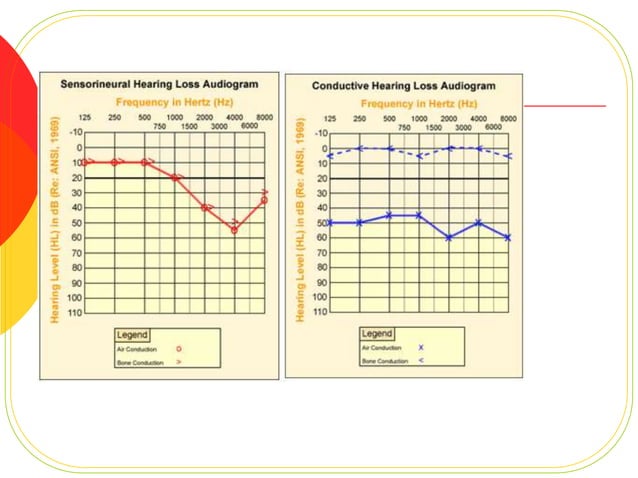 Pure tone audiometry | PPTX | Digital Audio | Computer Software and ...