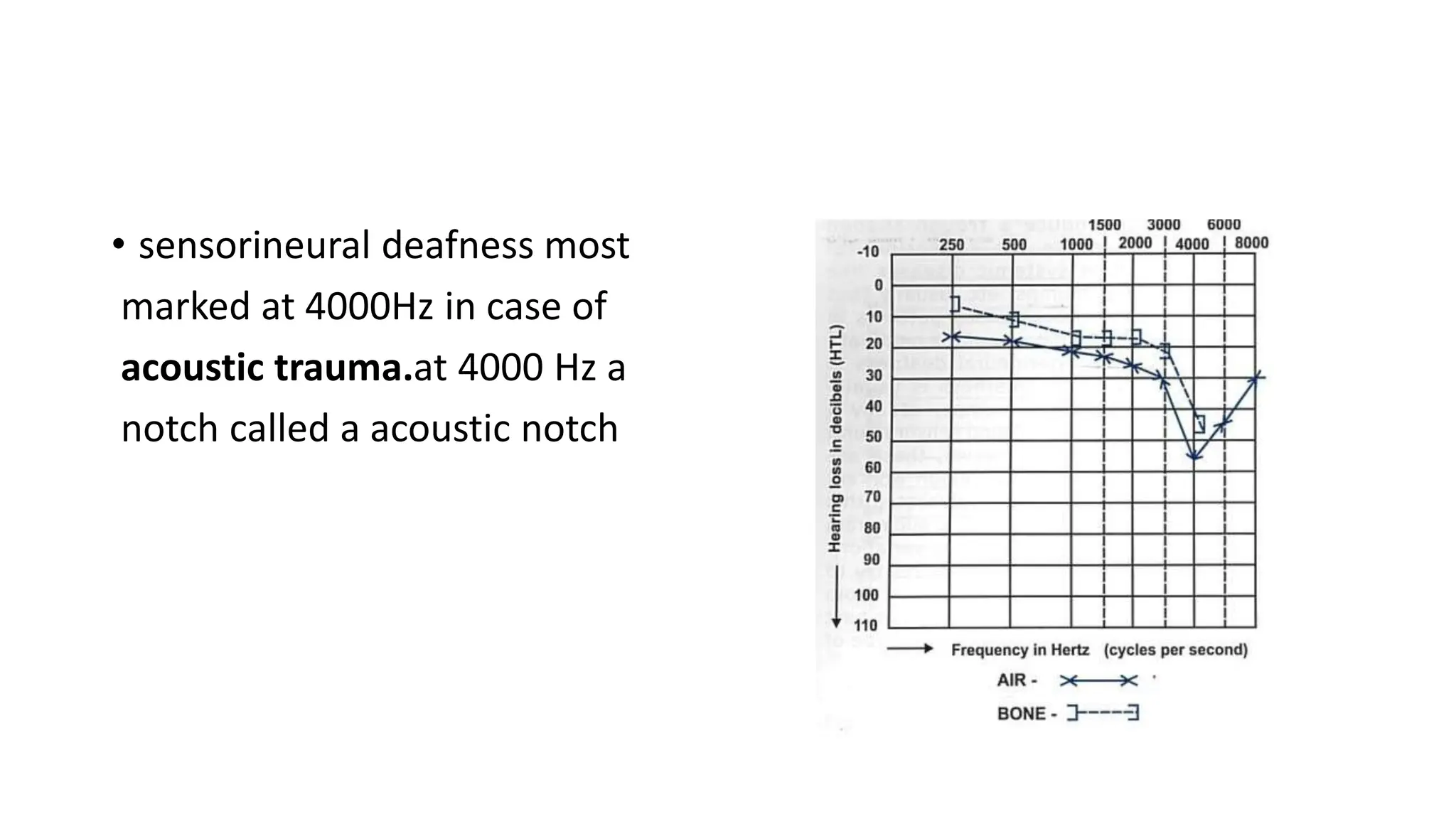 PURE TONE AUDIOMETRY for assesment of hearing | PPTX