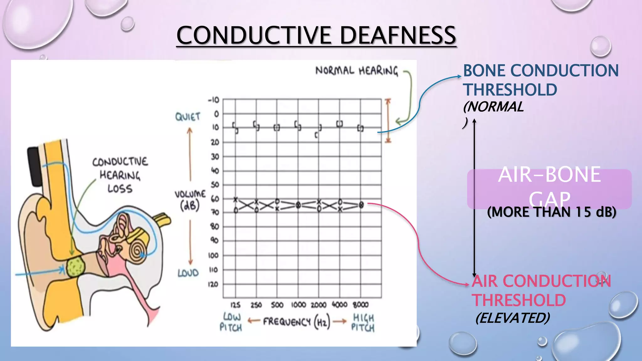 Pure tone audiometry | PPTX