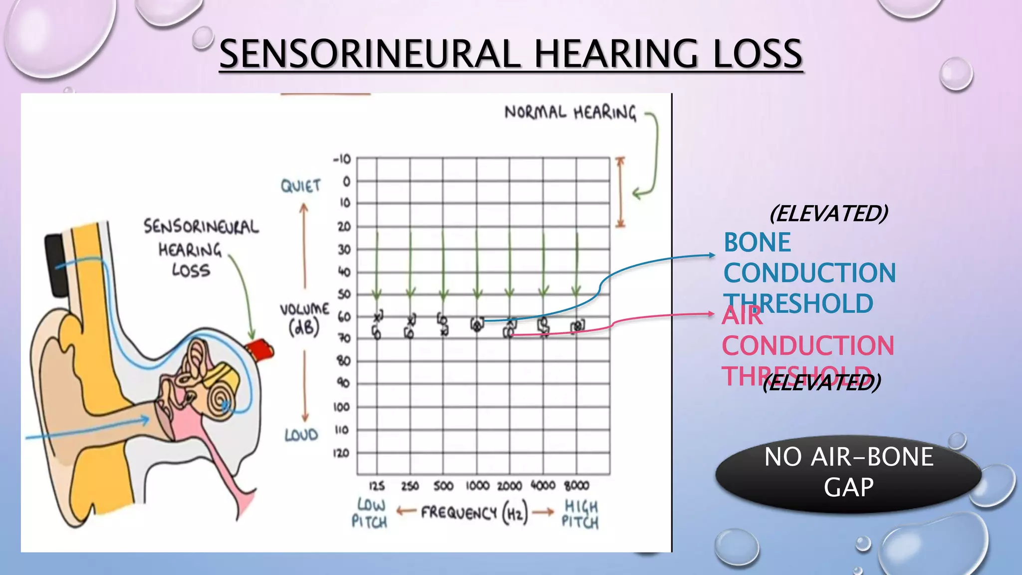 Pure tone audiometry | PPTX