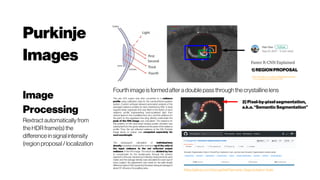Multispectral Purkinje Imaging | PPT