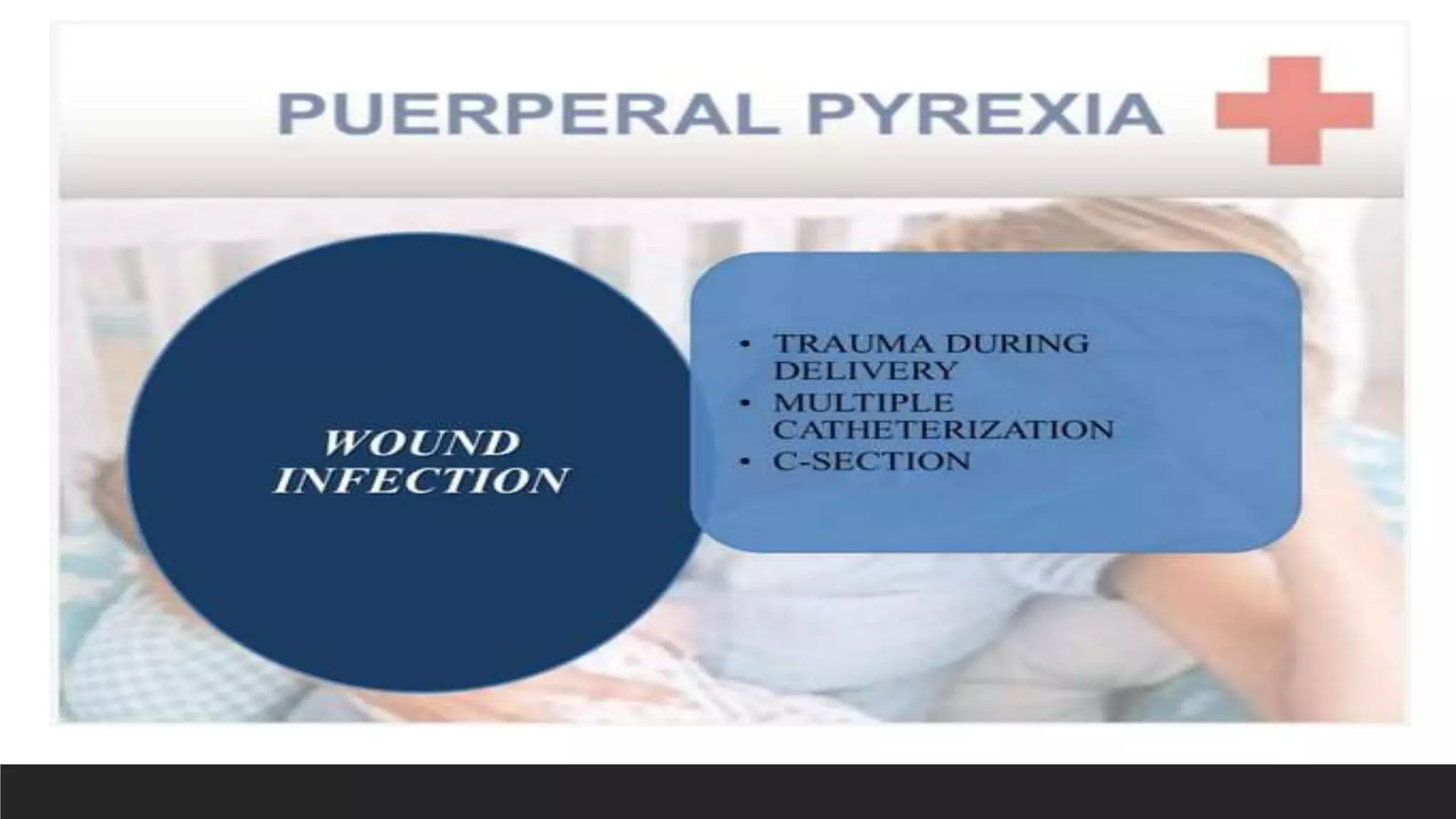 purperial pyrexia ppt.pptx | Infectious Diseases | Diseases and Conditions