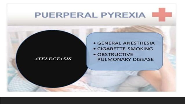 purperial pyrexia ppt.pptx