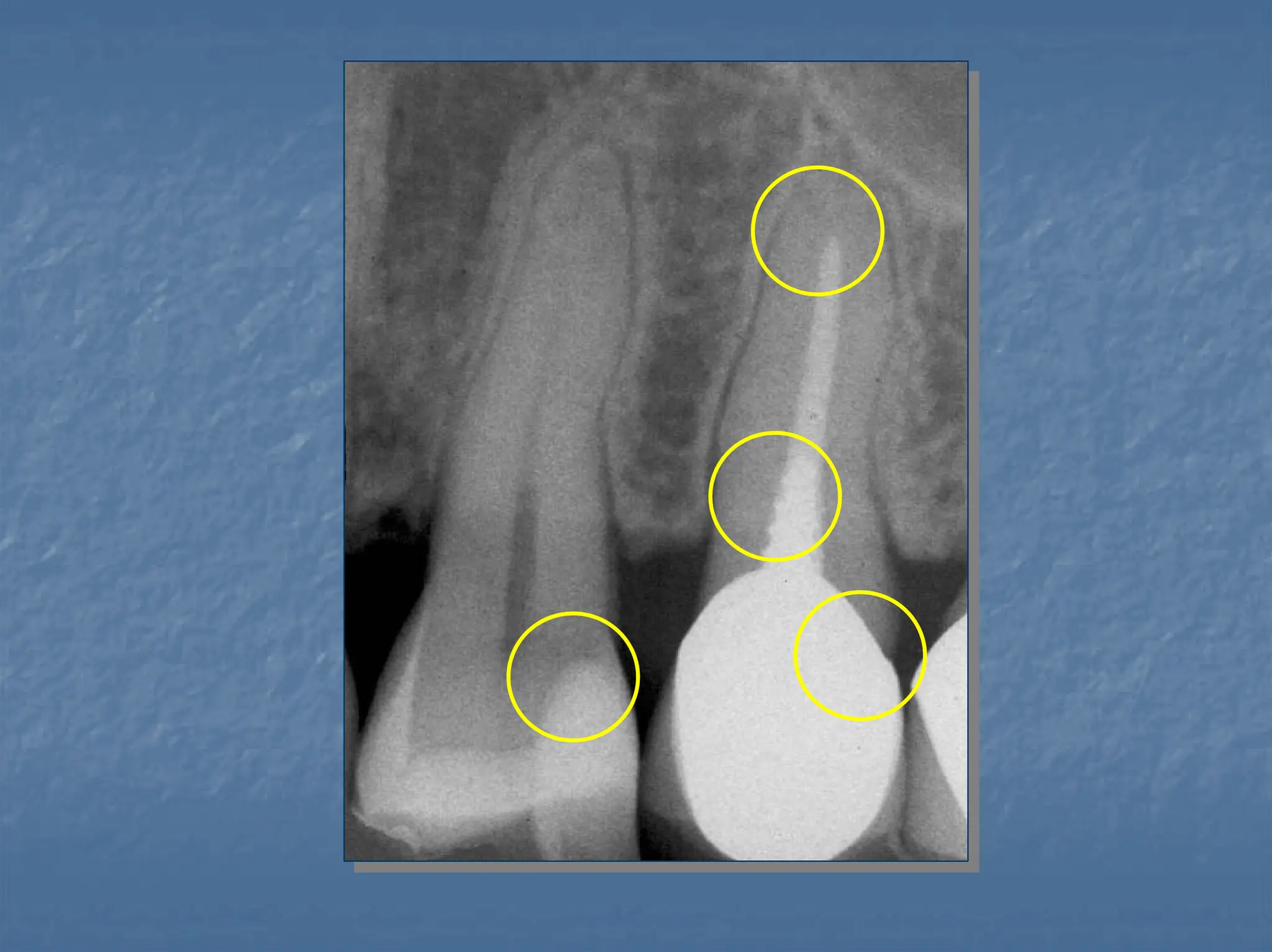 Purpose, rationale, and importance of obturation.pdf