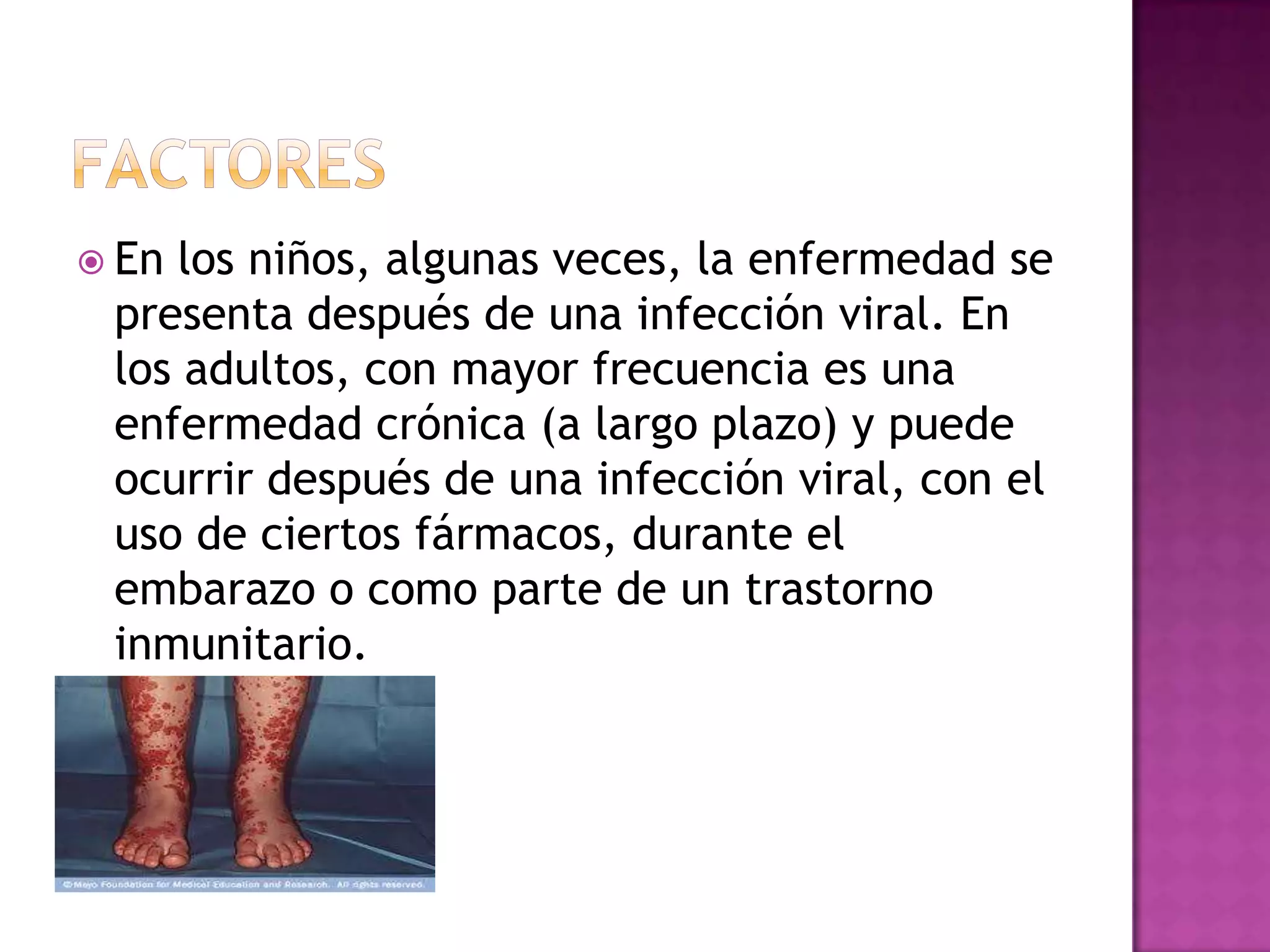 Purpura trombocitopenica por anticuerpo | PPTX