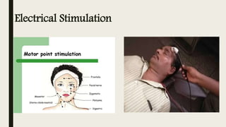 Bell's Palsy ICIDH2 Purvi Shah PPT | PPT