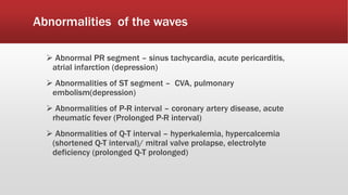 Purvi shah ecg ppt | PPTX