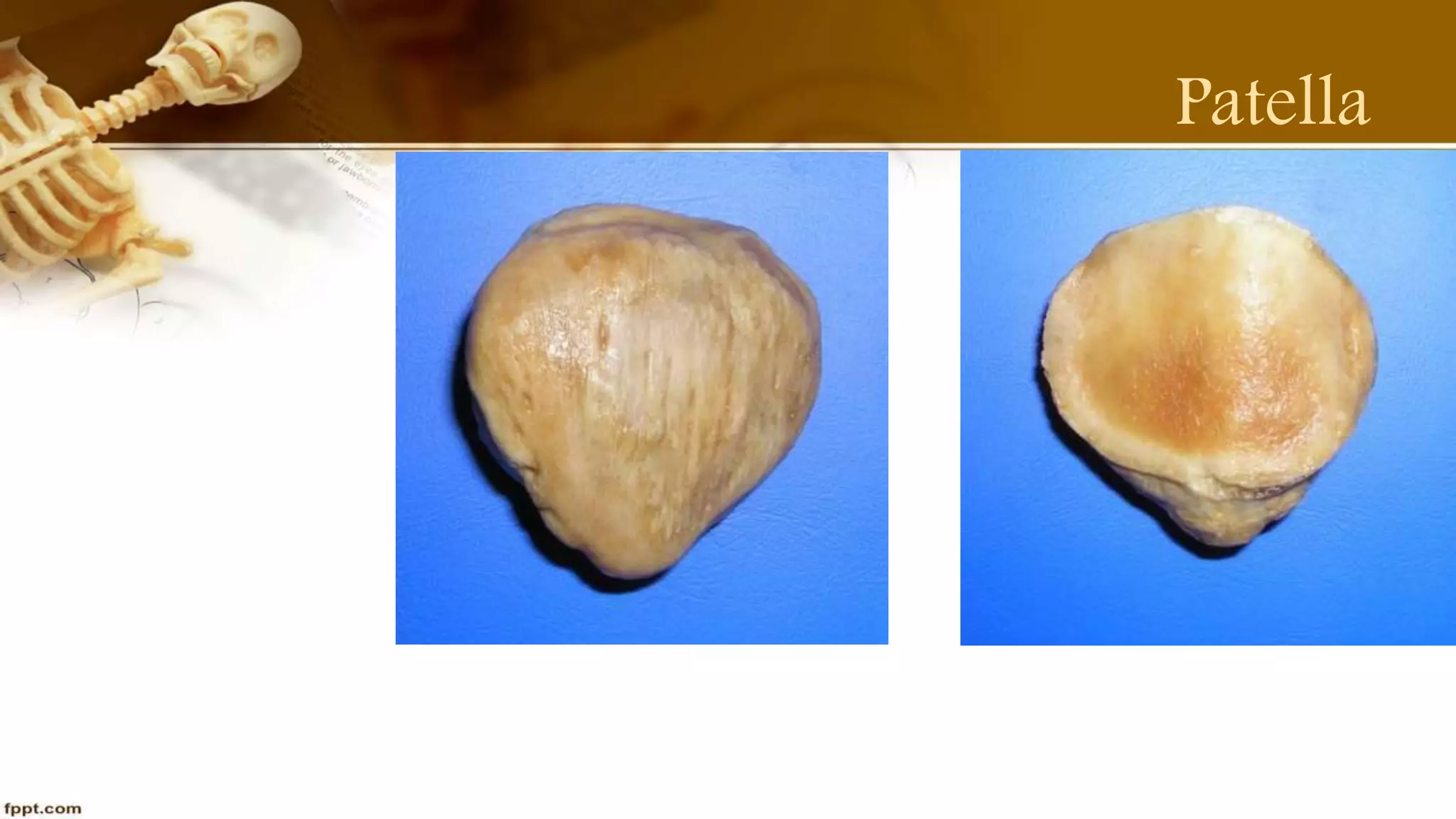 Purvi shah Anatomy Of patella PPT | PPTX