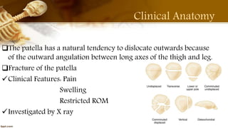 Purvi shah Anatomy Of patella PPT | PPTX