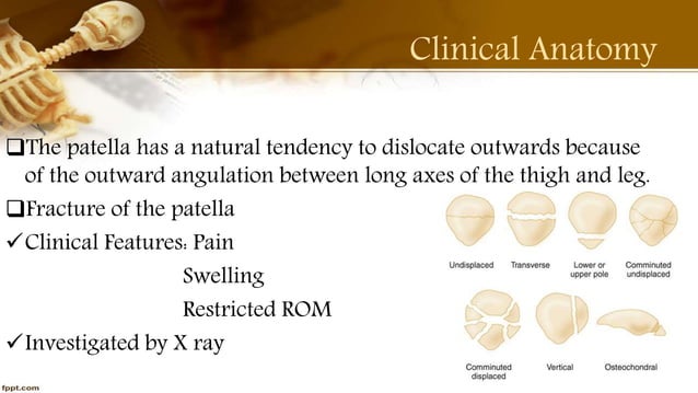 Purvi shah Anatomy Of patella PPT | PPTX