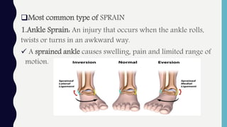Purvi shah sprain ppt | PPT