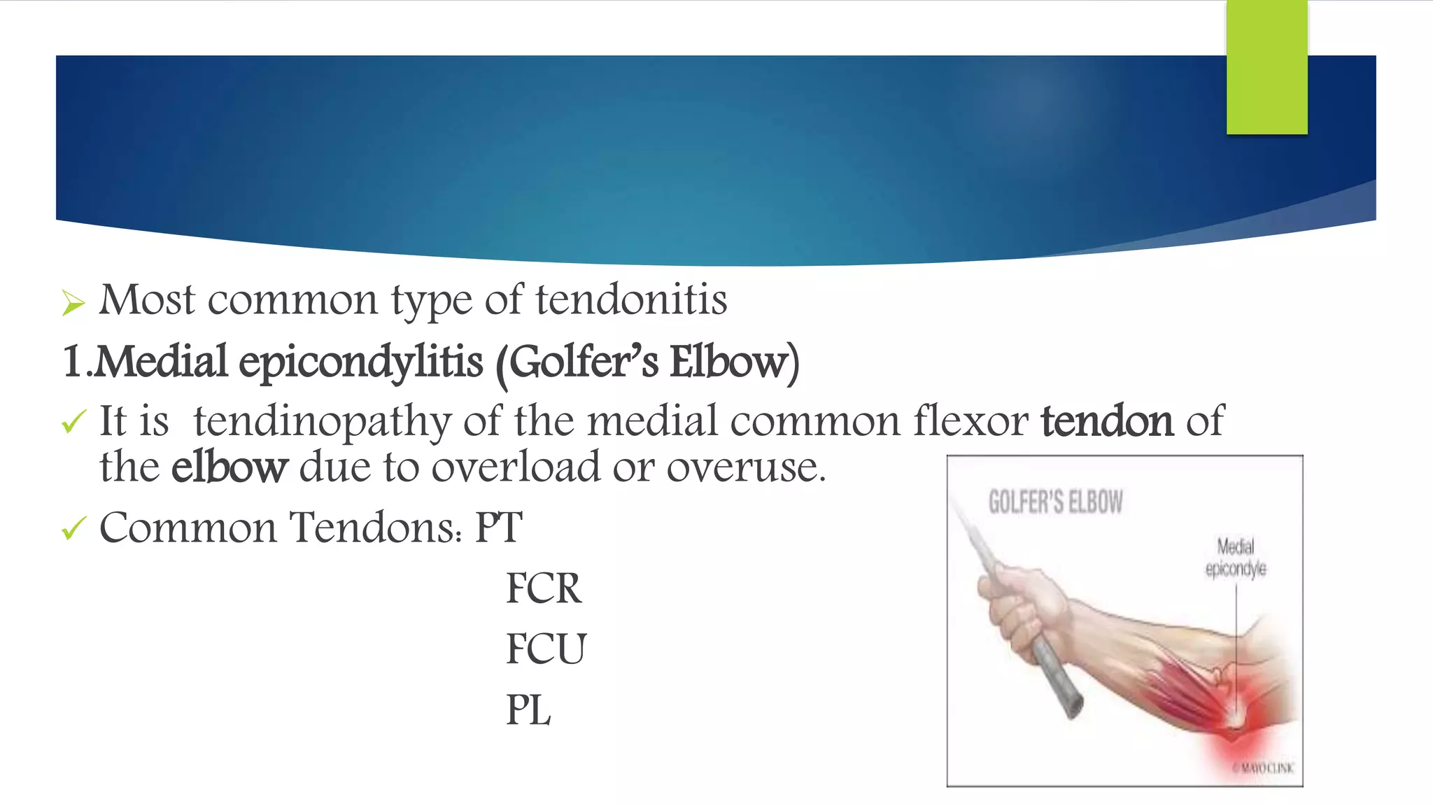 Purvi shah tendonitis ppt | PPTX