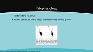 Pusher Syndrome | PPTX