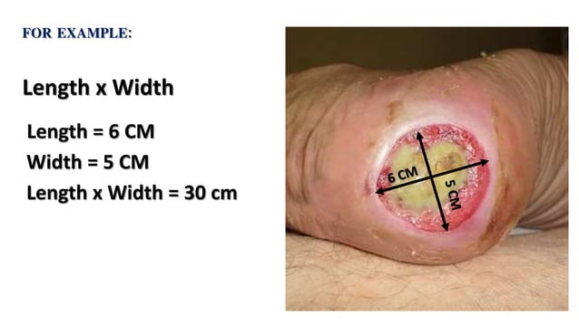Push scale | PPTX | First Aid | Injuries