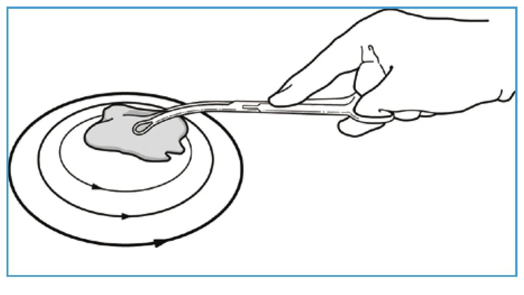 Pus Sample Collection & Processing (1).pptx