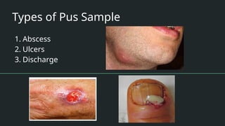 Pus Sample Collection & Processing (1).pptx