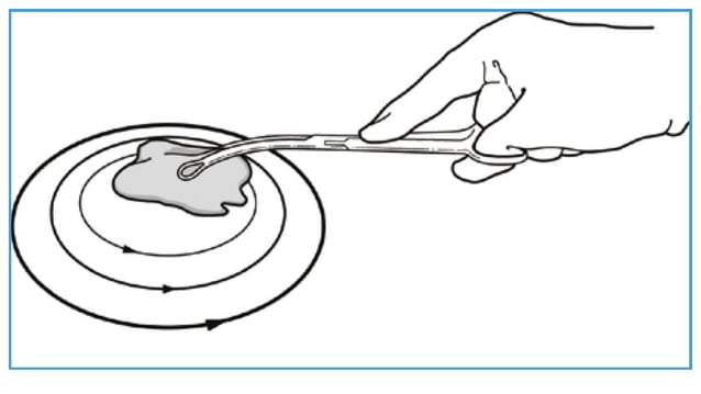 Pus Sample Collection & Processing (1).pptx