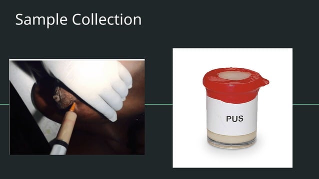 Pus Sample Collection & Processing (1).pptx