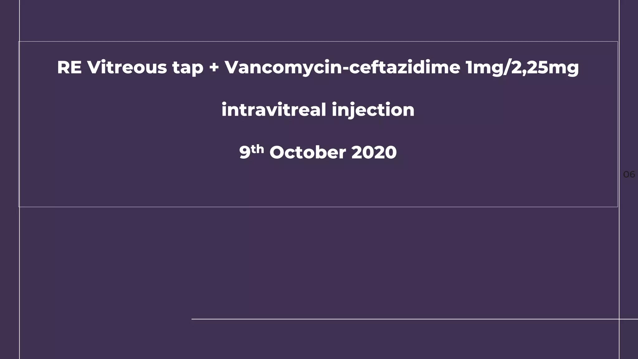 Acute Post Operative Endophthalmitis (Pseudomonas aeruginosa MDR) | PDF