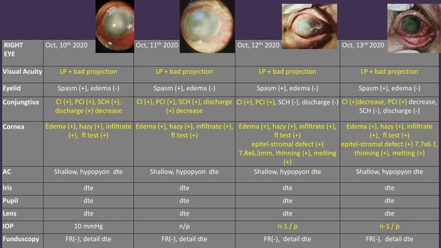 Acute Post Operative Endophthalmitis (Pseudomonas aeruginosa MDR) | PDF ...
