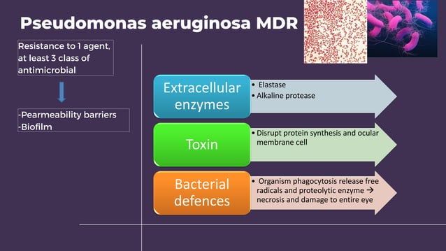 Acute Post Operative Endophthalmitis (Pseudomonas aeruginosa MDR) | PDF | Eye and Vision ...