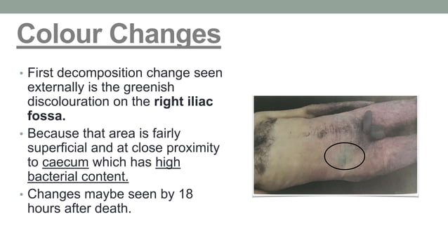 Putrefaction.pptx | Blood Disorders | Diseases and Conditions