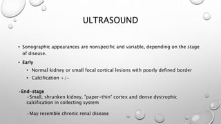 Putty kidney | PPT