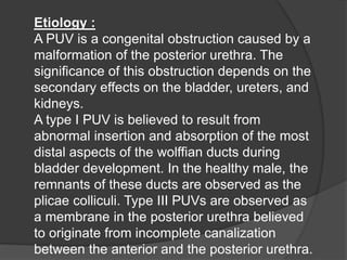 PUV Prepared By Dr Osam Almogahed.pptx