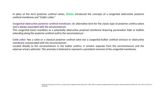 Posterior urethral valve managment DR SACHIN | PPTX