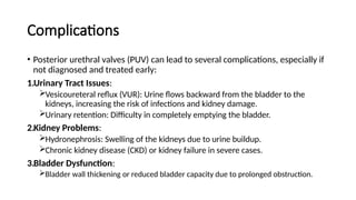 puv last draft: Posterior Urethral Valve (PUV) – Overview 1. | PPTX