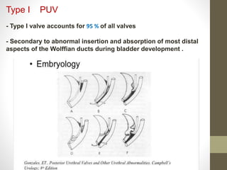 PUV presentation.pptx