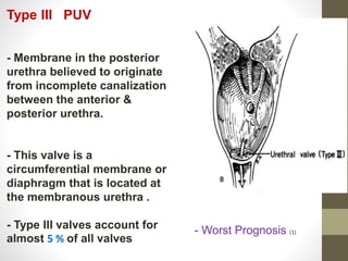 PUV presentation.pptx | Free Download