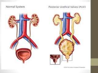 PUV presentation.pptx
