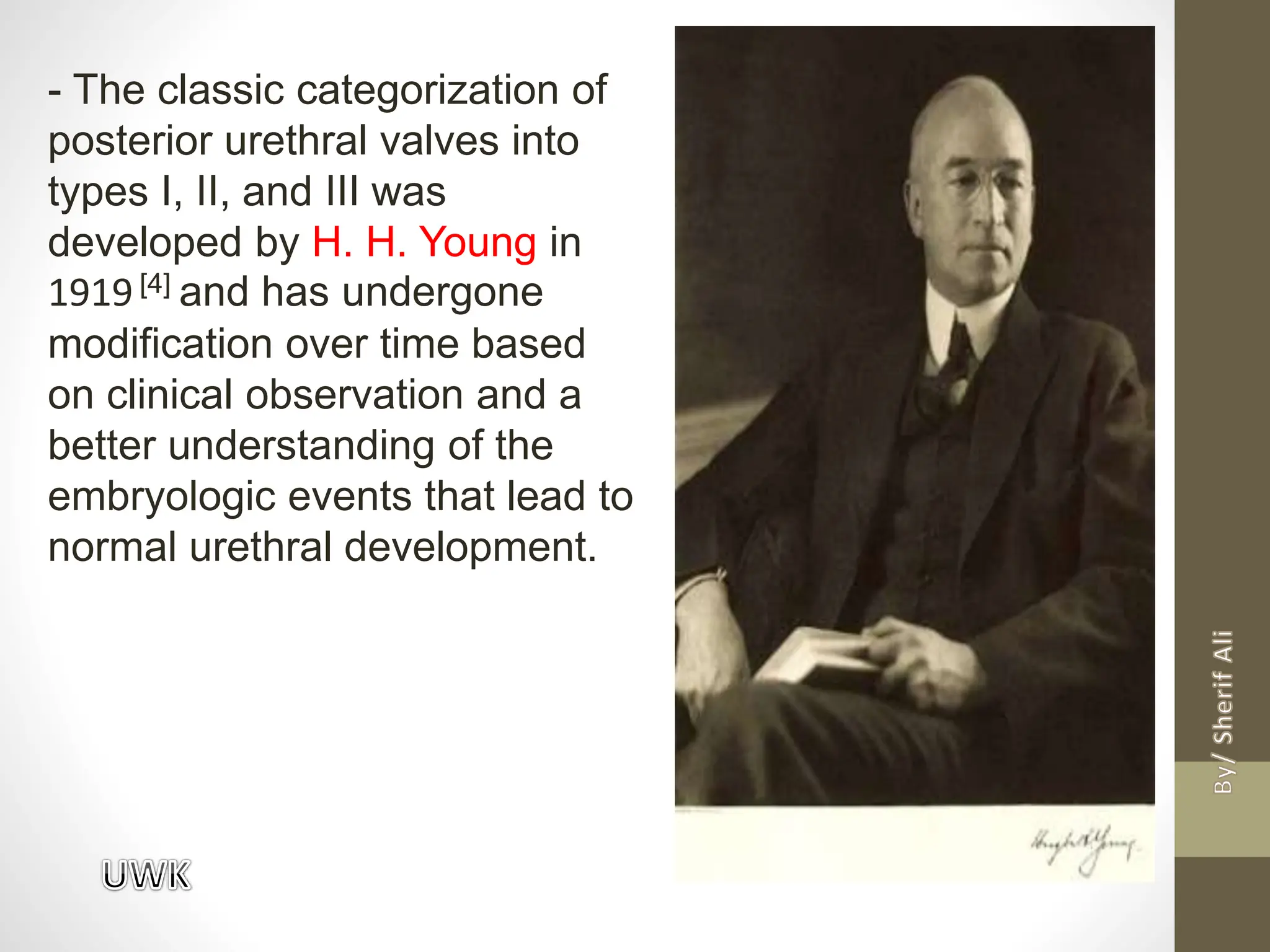 PUV presentation urology in sohag university.pptx