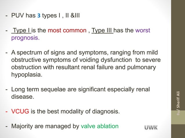 PUV presentation urology in sohag university.pptx