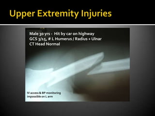 Pedestrian Vehicle Accidents 'Common Injuries Patterns' | PPTX