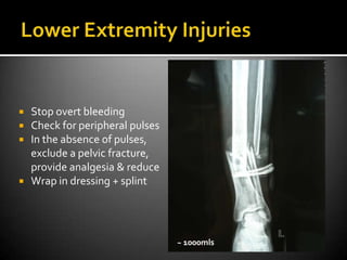 Pedestrian Vehicle Accidents 'Common Injuries Patterns' | PPTX
