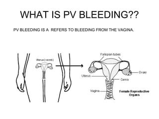 Pv Bleeding A+E | PPT