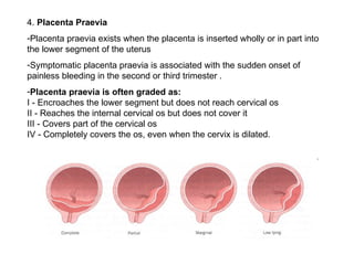Pv Bleeding A+E | PPT