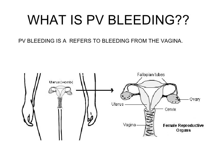Pv Bleeding A E Pv Bleeding A E