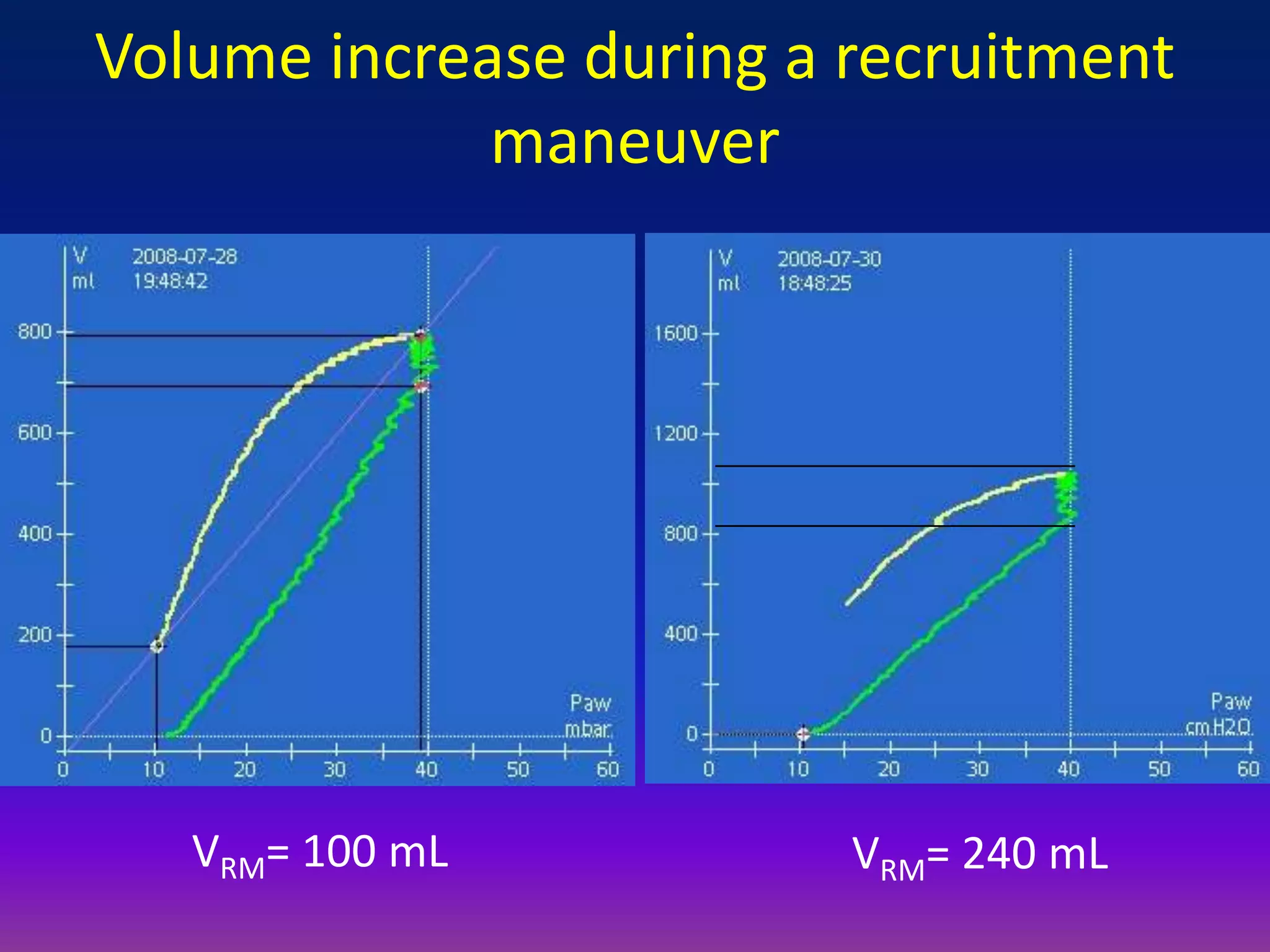 PV Curve and Lung Recruitment | PPTX