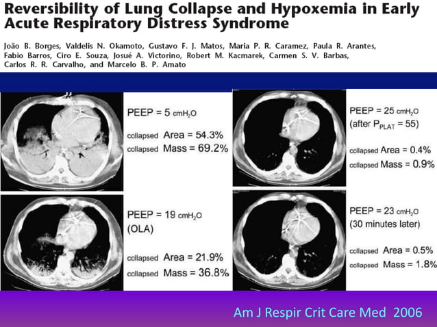 PV Curve and Lung Recruitment | PPTX | Lung and Respiratory Health ...