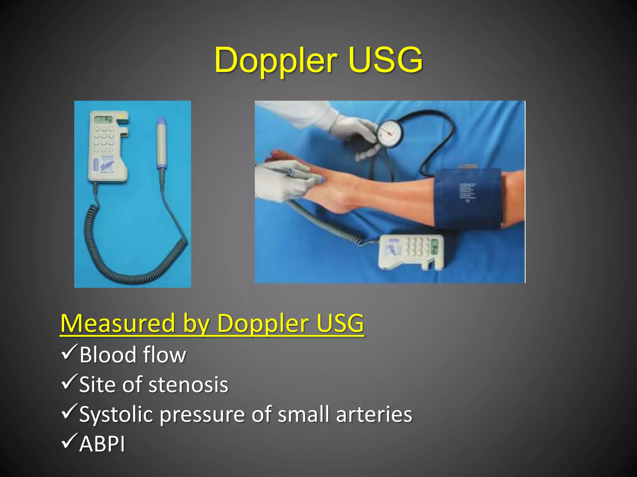 peripheral vascular disease | PPTX