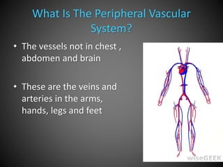 peripheral vascular disease | PPTX