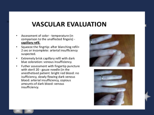 peripheral vascular diseases overview and physiology | PPT