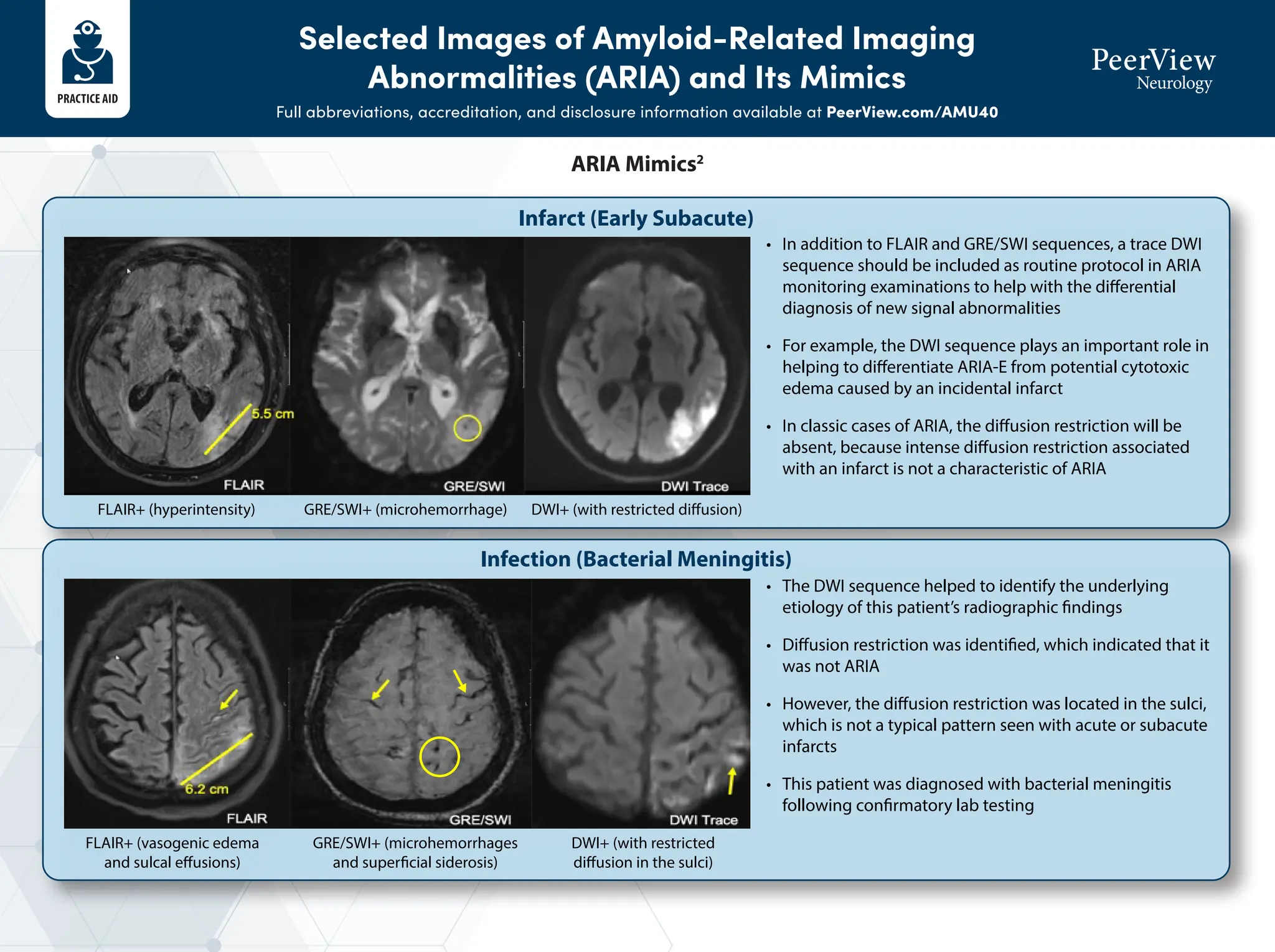 Navigating Advances in Alzheimer’s Disease: An Expert Consult on ...