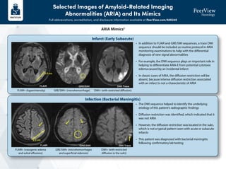 Navigating Advances in Alzheimer’s Disease: An Expert Consult on ...