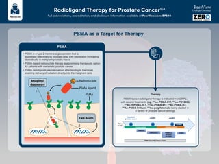 Navigating Therapeutic Choices in Prostate Cancer: Effective Decision ...