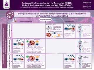 Unleashing the Potential of Perioperative Immunotherapy in Resectable ...