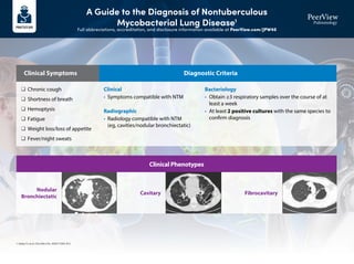 Experts vs AI Challenge: Diagnosing and Managing Nontuberculous Mycobacterial Lung Disease | PPT